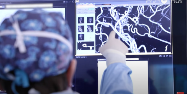 Neuroradiologie interventionnelle | Hôpital Bicêtre